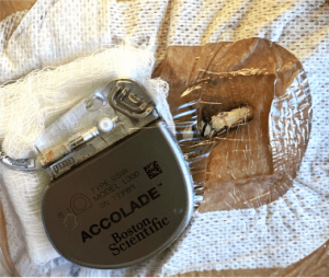 A Pacemaker quiz and a new concept. | Dr.S.Venkatesan MD